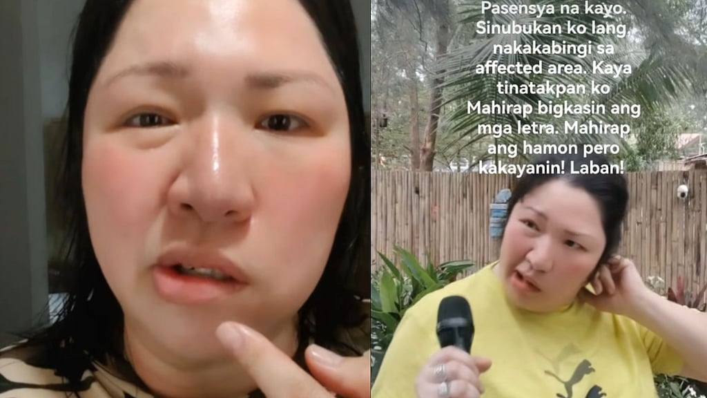 Frenchie Dy Shares Her Battle with Bell’s Palsy for the Third Time