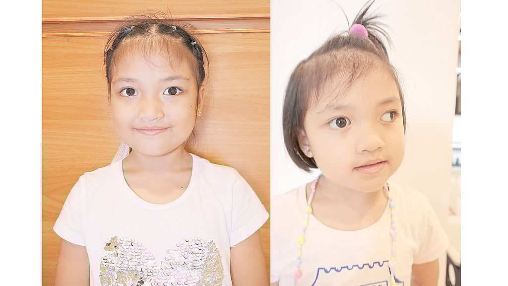 Tzu Chi Eye Center treats kids with strabismus