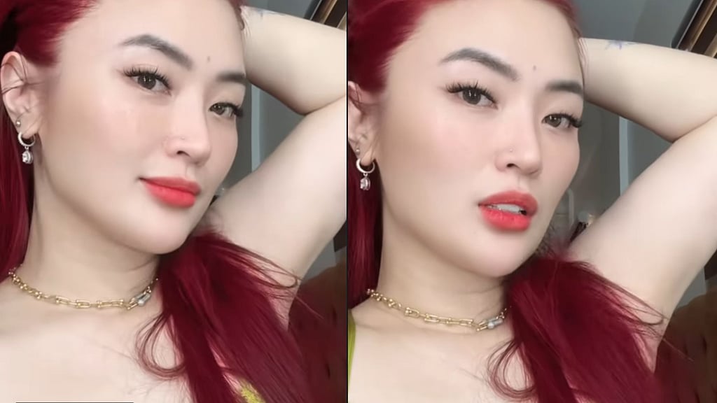 Vlogger Jellie Aw Shows Recovery from Alleged Attack by Fiancé Jam Ignacio