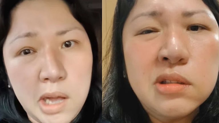 Vocal Powerhouse Frenchie Dy Shows Improvement in Bell’s Palsy Recovery