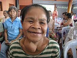 Experts: 9% of adult Filipinos have goiter