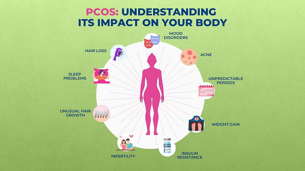 Understanding and managing PCOS: a guide to empowerment