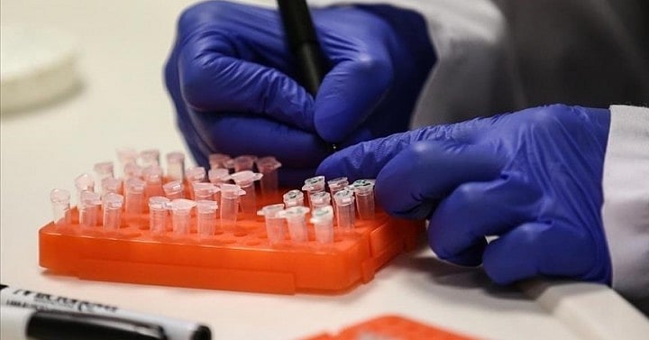 Quezon City reports first mpox case
