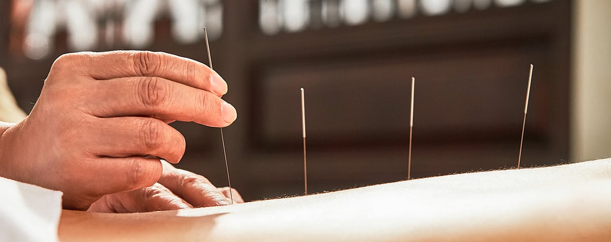 Unleashing the power of needles