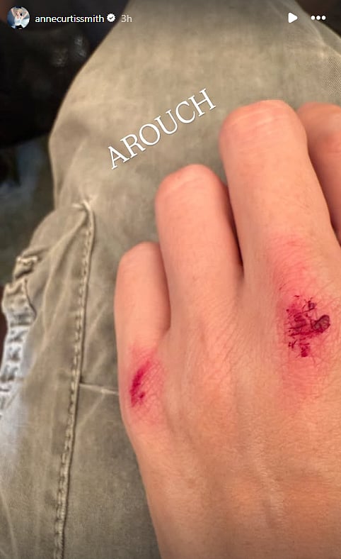 Anne Curtis Shares Intense Behind-the-Scenes of Erik Matti's Latest ...