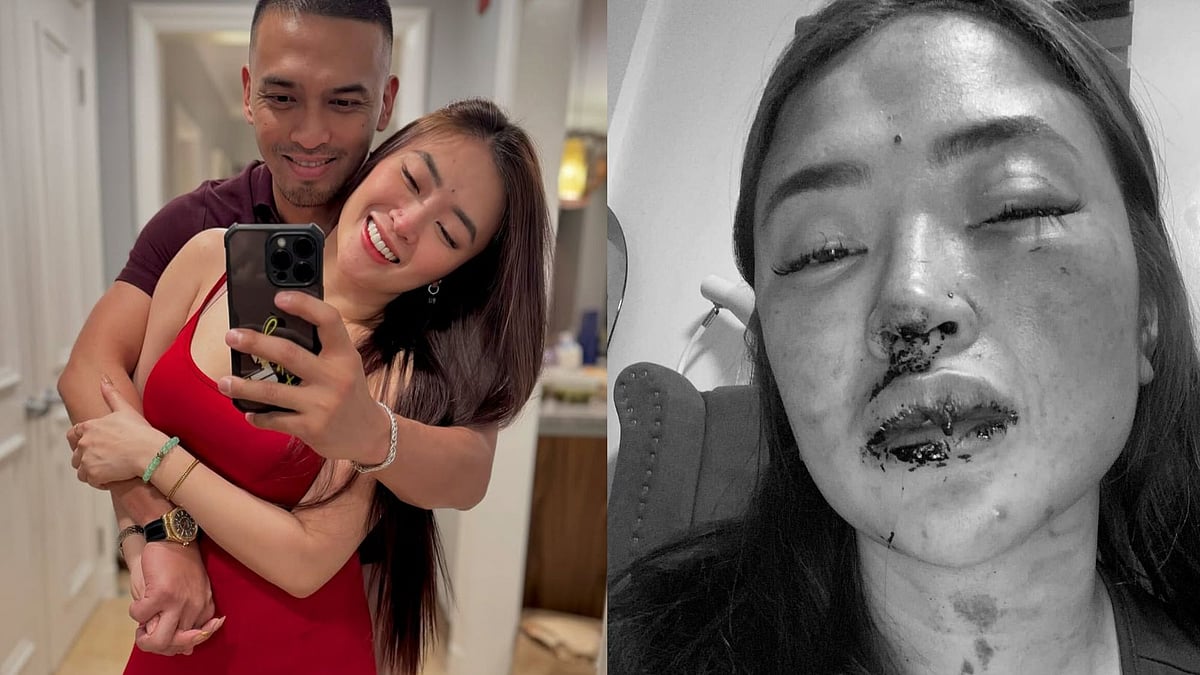 Jam Ignacio Apologizes to Fiancée Jellie Aw Amid Assault Allegations ...