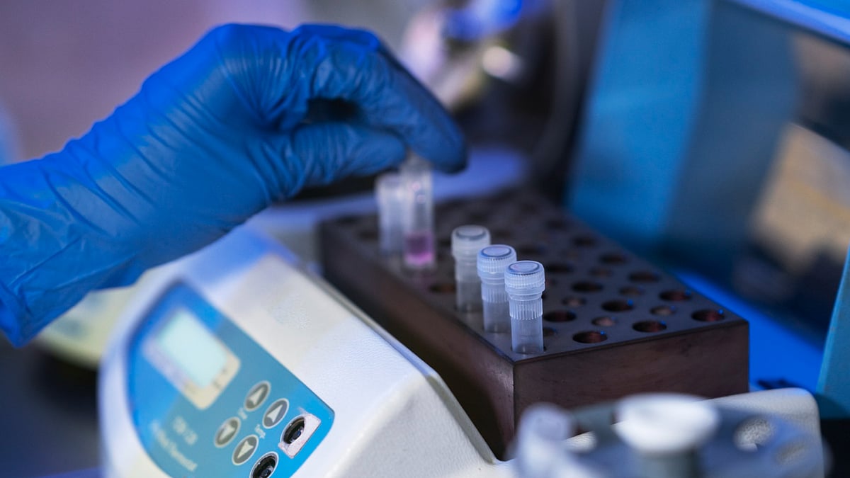 ICMR Validates Indigenous TB Detection Tools for Affordable Diagnosis