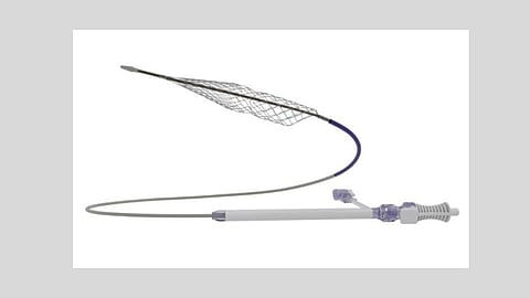Inari Medical Launches Next-Gen InThrill Thrombectomy System