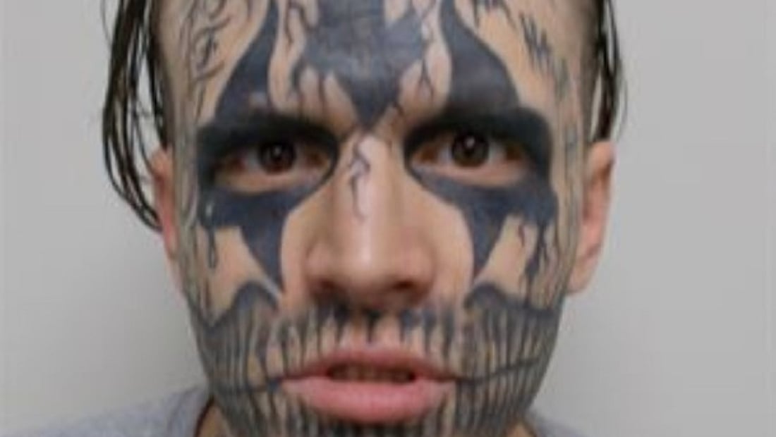 HE WON'T BE HARD TO MISS: Ontario police searching for suspect with ...